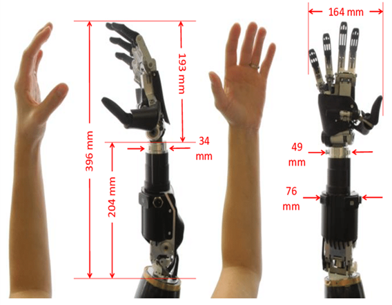 PROSTHETIC ARM - IEM Group